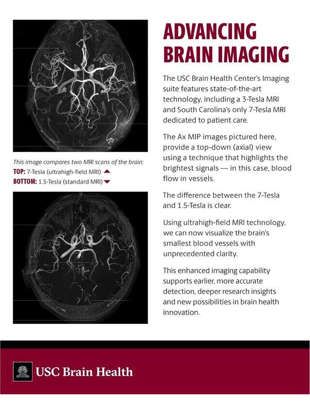 USC’s state-of-the-art brain center opening soon in Columbia | The State